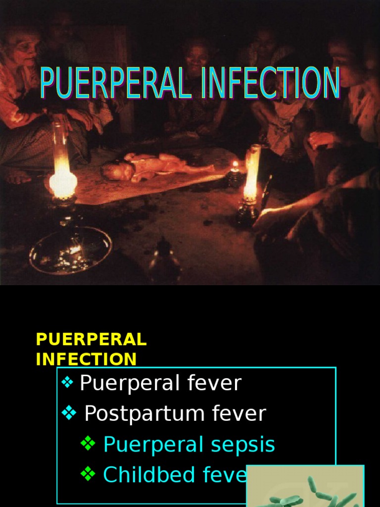 Puerperal Infection Management Guide | PDF | Vagina | Childbirth