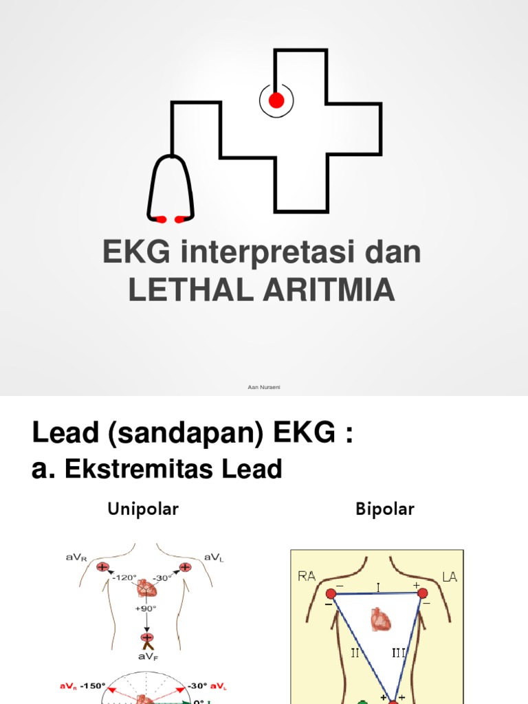 EKG Interpretasi Dan Lethal Aritmia: Aan Nuraeni | PDF | Electrocardiography | Heart Rate