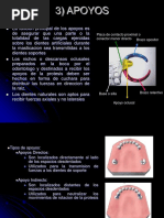 Protocolo Impresión Definitiva para Protesis Total | PDF | Dentadura ...