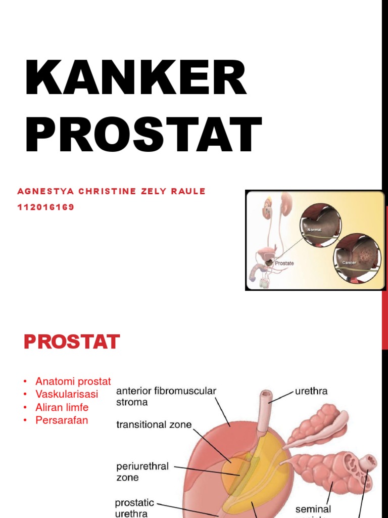 CA Prostat | PDF | Sains & Matematika
