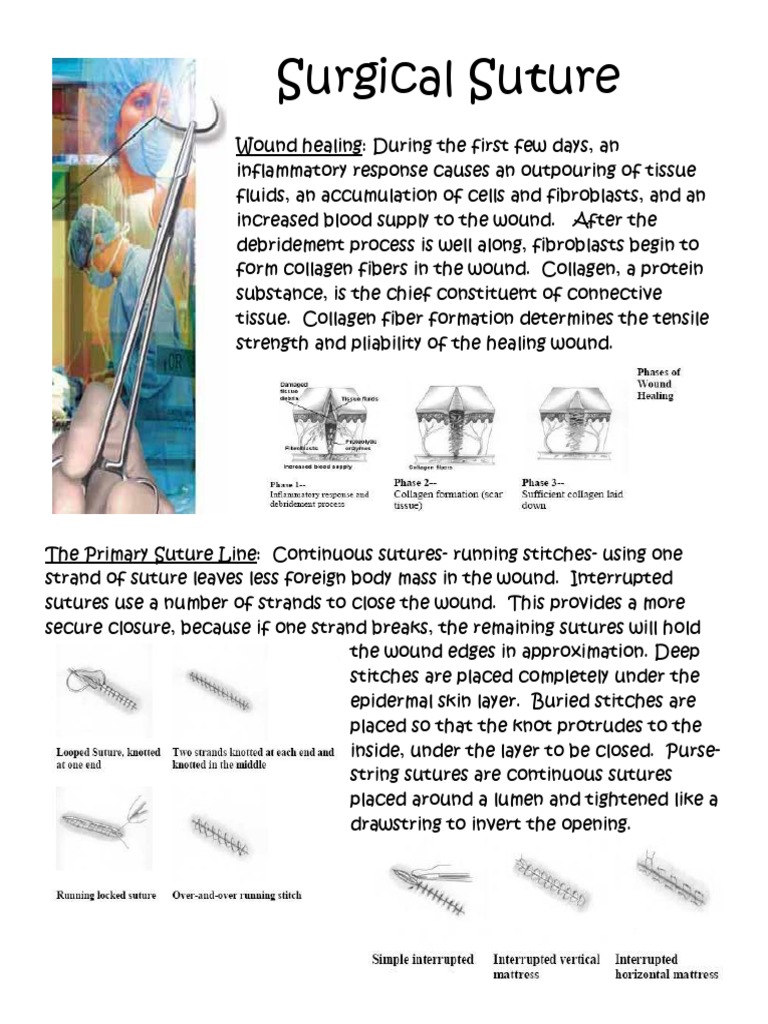 Suture | PDF | Surgical Suture | Healing