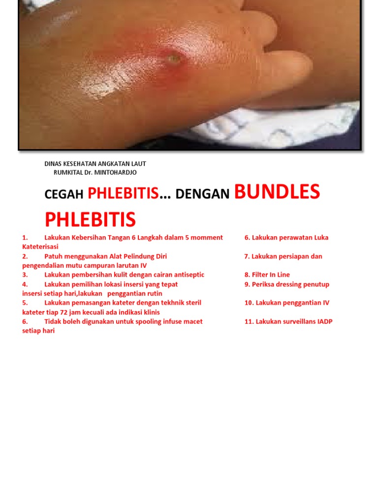 Bundles Plebitis | PDF