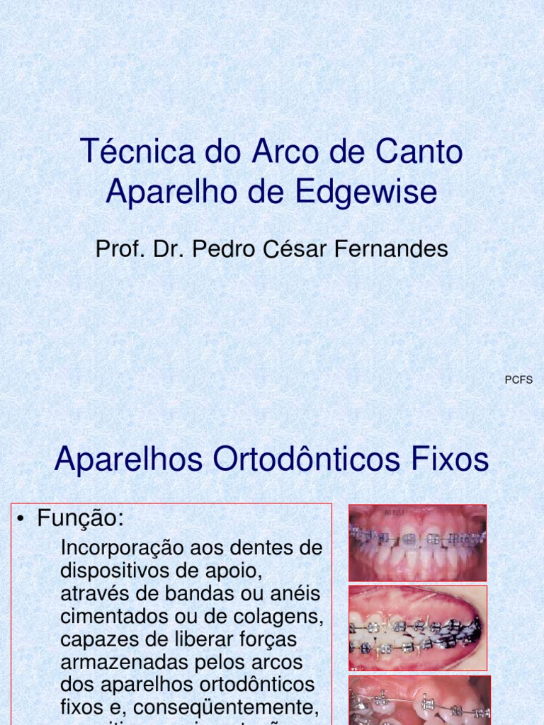 Técnica Do Arco de Canto-1-Introdução | PDF | Dente | Arco e flecha
