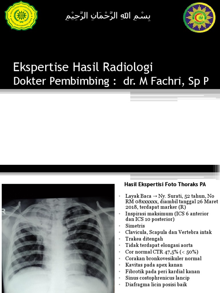 Ekspertise Hasil Radiologi | PDF