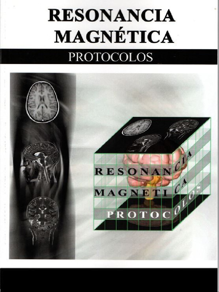 Resonancia Magnetica Protocolos | PDF