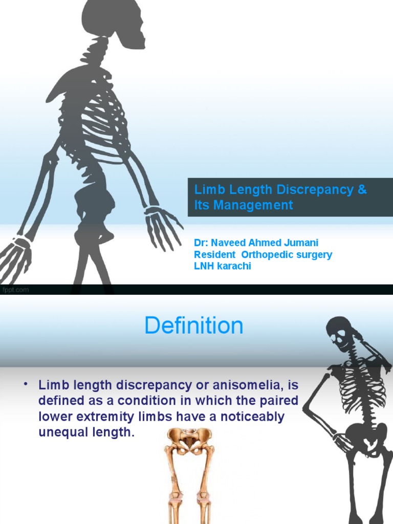 Limb Length Discrepancy | PDF | Clinical Medicine | Musculoskeletal System