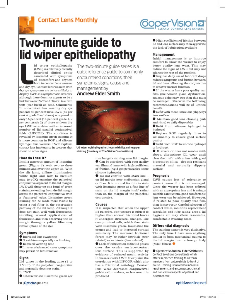 Lid Wiper Epitheliopathy Overview | PDF | Contact Lens | Vision