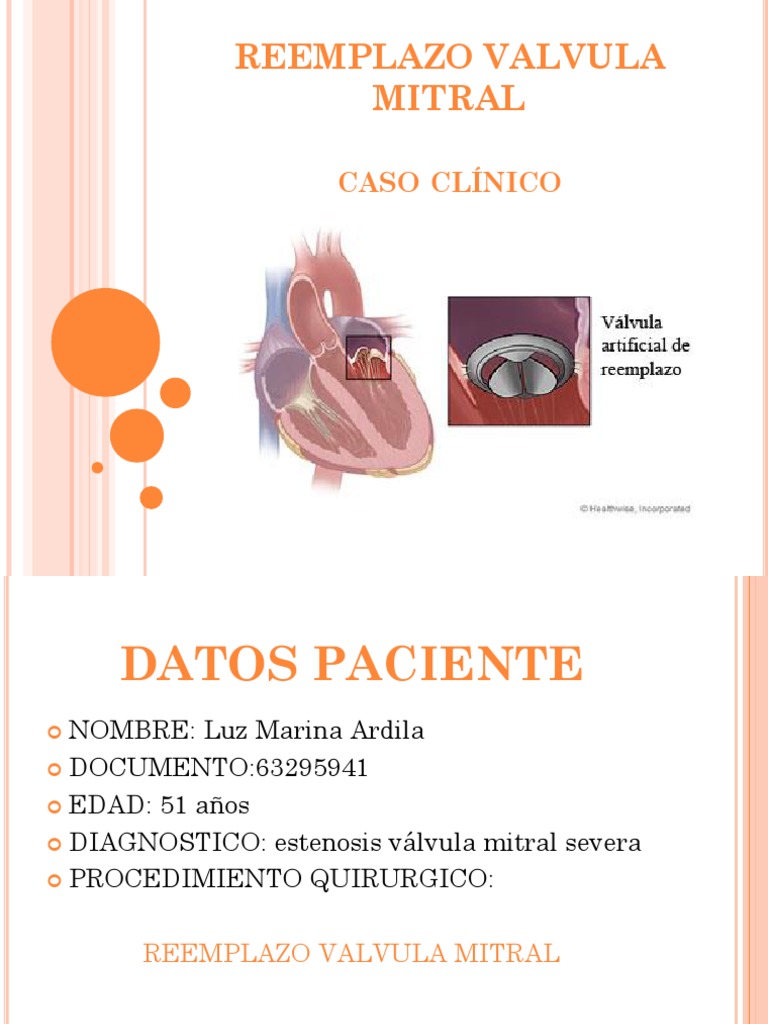 Reemplazo Valvula Mitral | PDF | Ventrículo (corazón) | Corazón