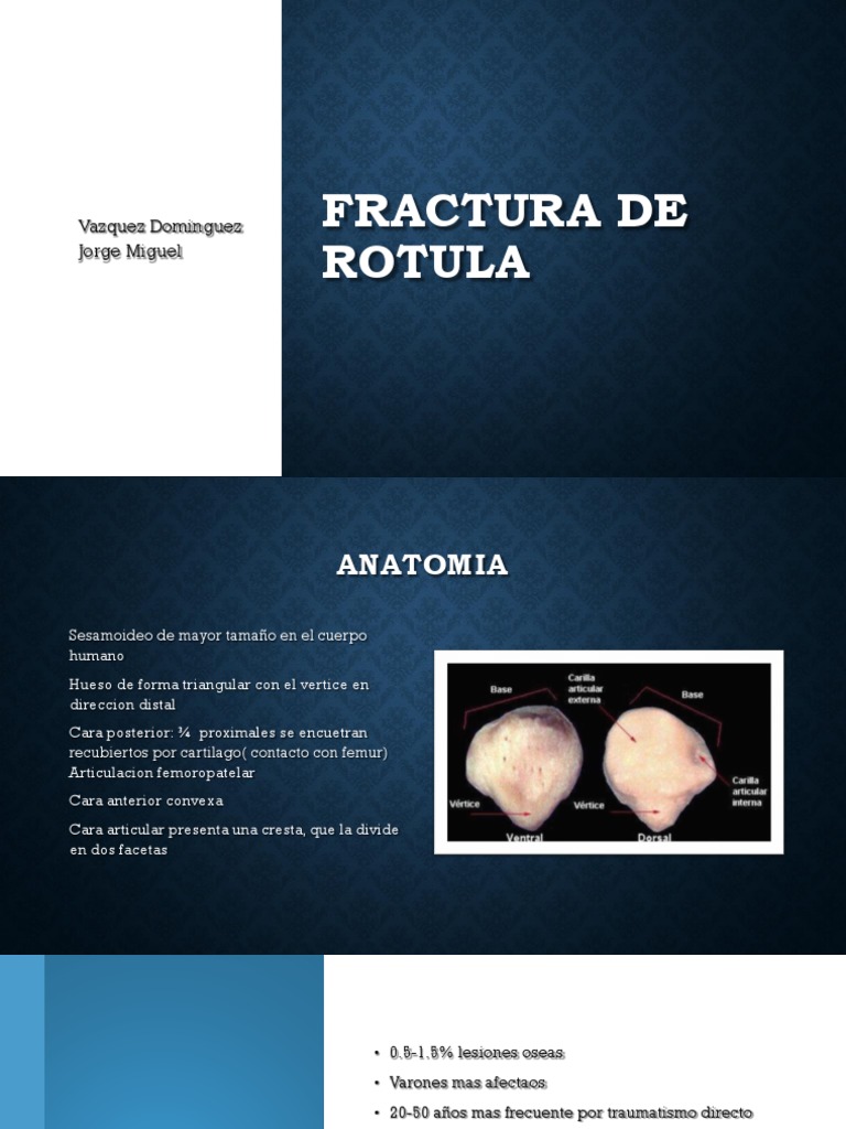 28fractura de Rotula | PDF | Lesión | Traumatologia