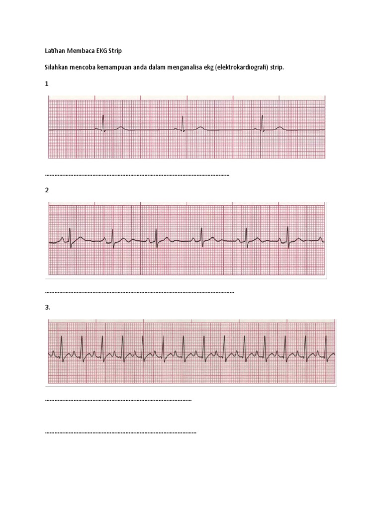 Latihan Membaca EKG Strip | PDF | Sains & Matematika
