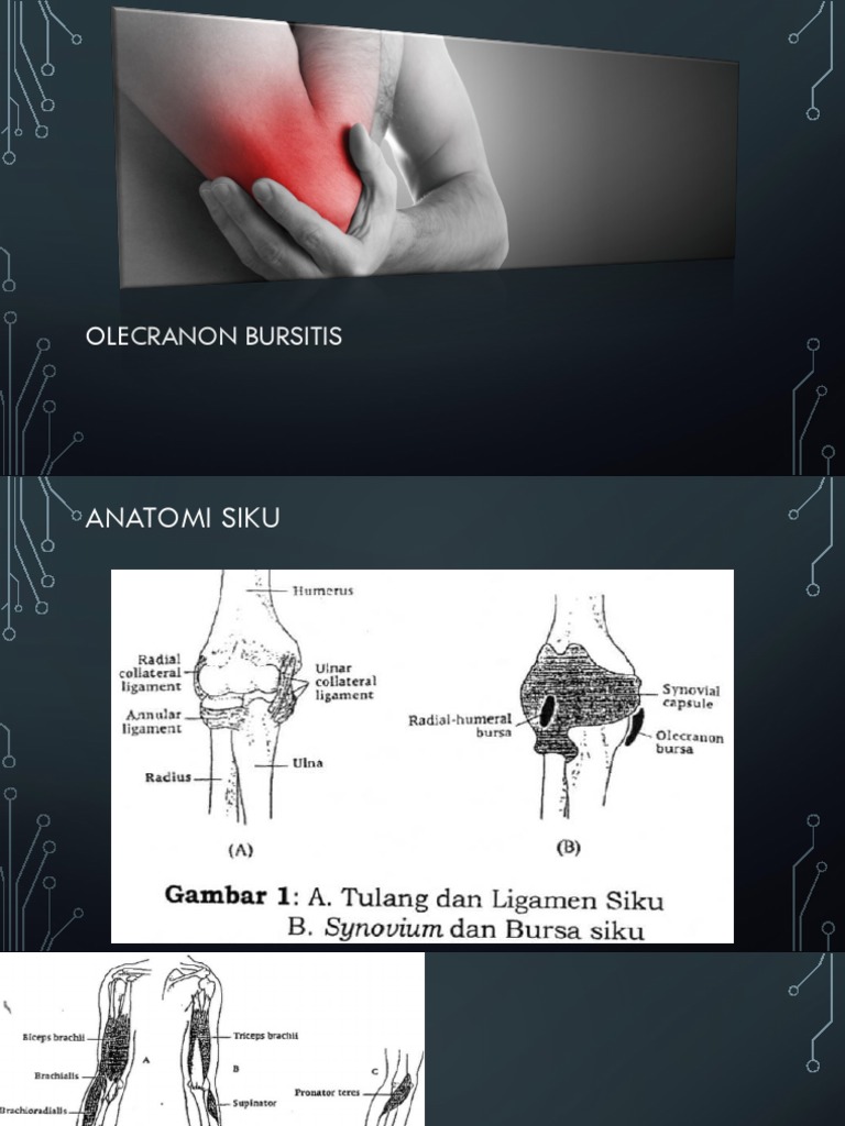 Bursitis Elbow Dan Trigger Finger | PDF