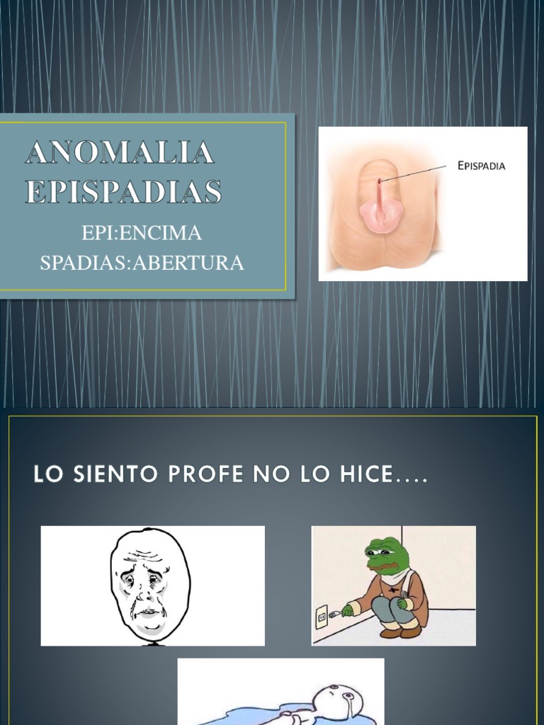 Anomalia Epispadia | PDF