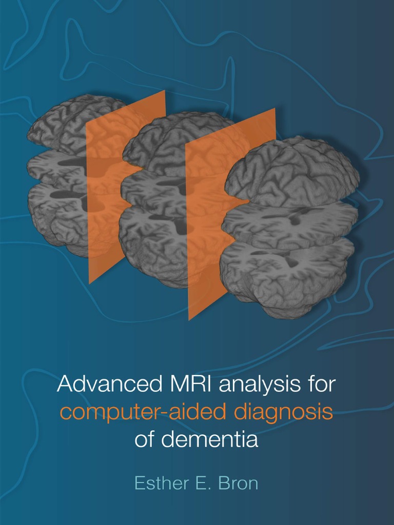 Esther Bron PHD Thesis PDF | PDF | Receiver Operating Characteristic ...