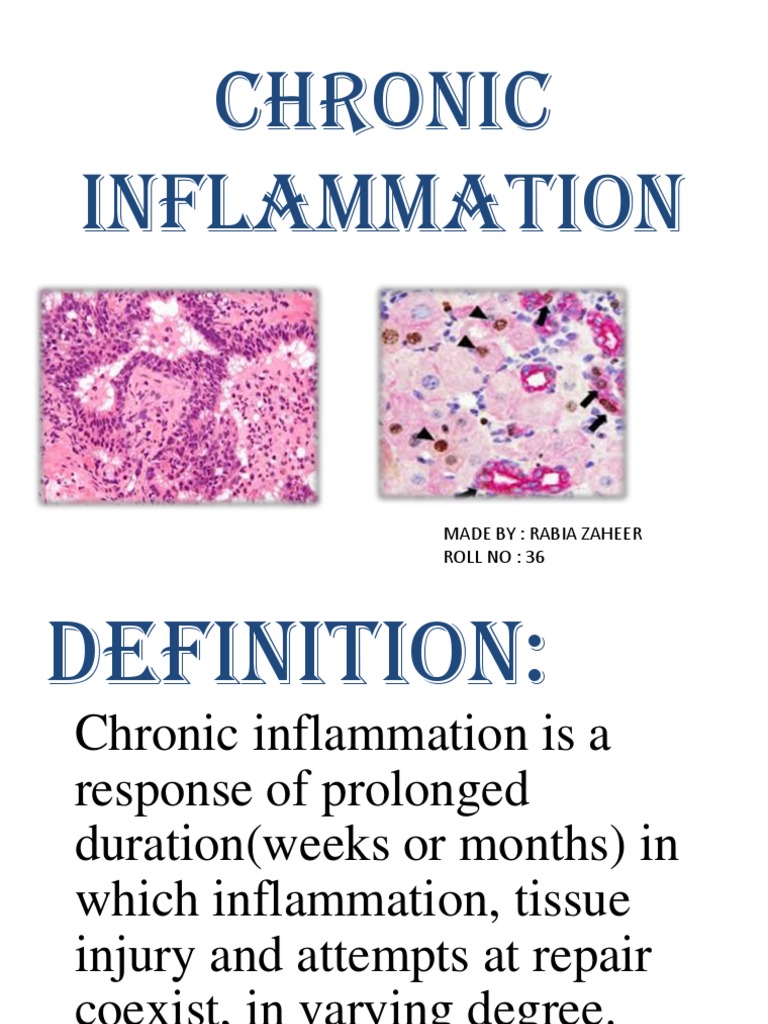 Understanding Chronic Inflammation | PDF