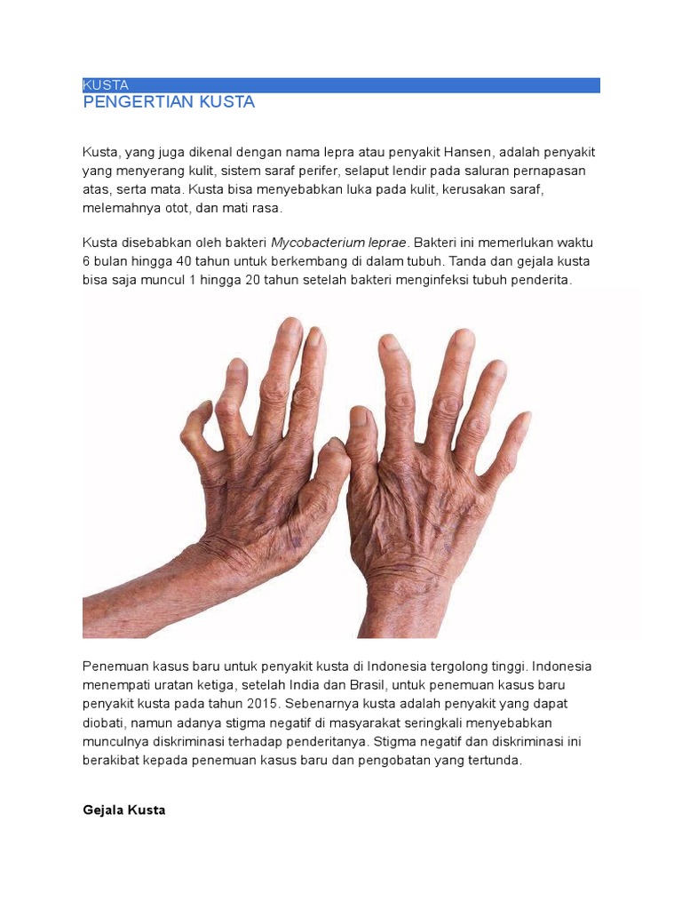 Penyakit Kusta: Gejala dan Pengobatan | PDF