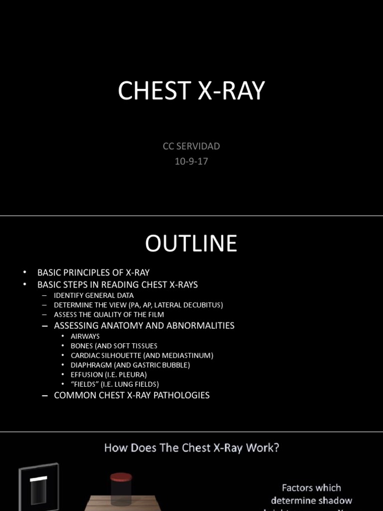 Chest X-Ray | PDF | Lung | Thorax