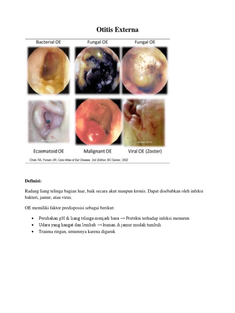 Otitis Externa | PDF