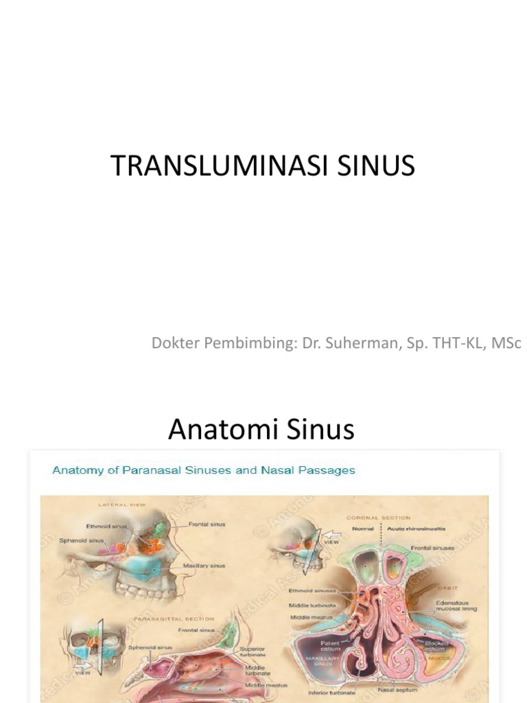 Transiluminasi Sinus | PDF