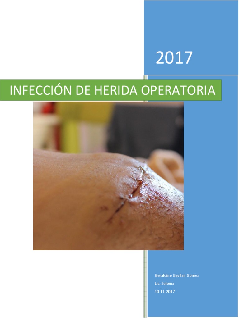 Infección de Herida Operatoria | PDF | Herida | Mycobacterium