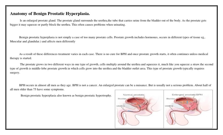 Anatomy of Benign Prostatic Hyperplasia | PDF