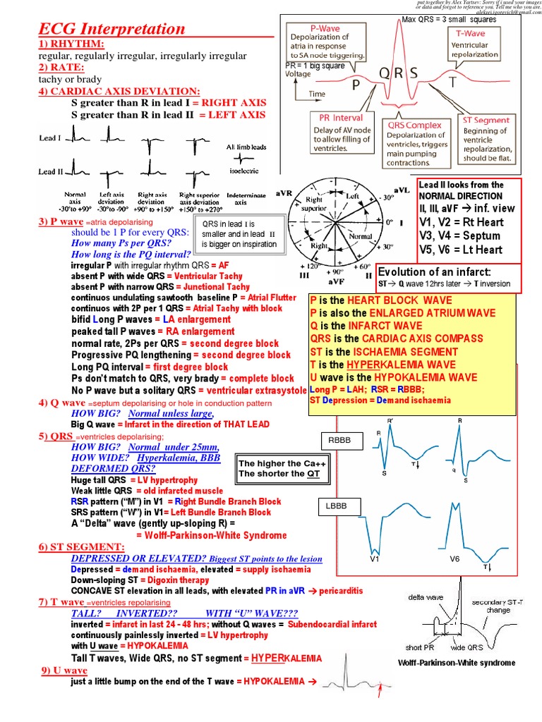 ECG-Interpretation-Cheat-Sheet 1 PDF | PDF | Electrocardiography ...