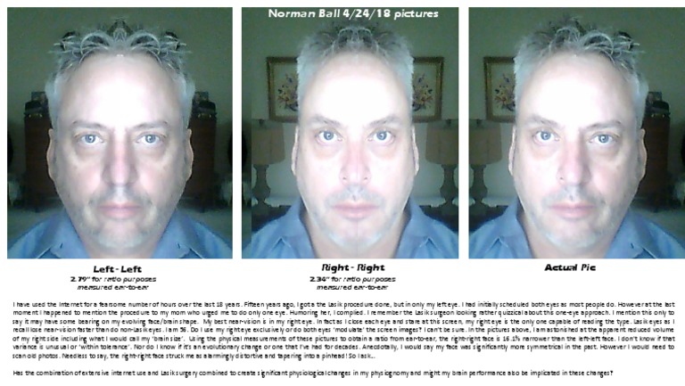 Impact of Lasik and Internet Use on Face Shape | PDF