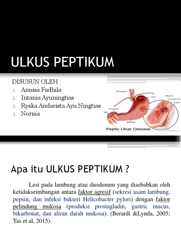 Ulkus Peptikum | PDF