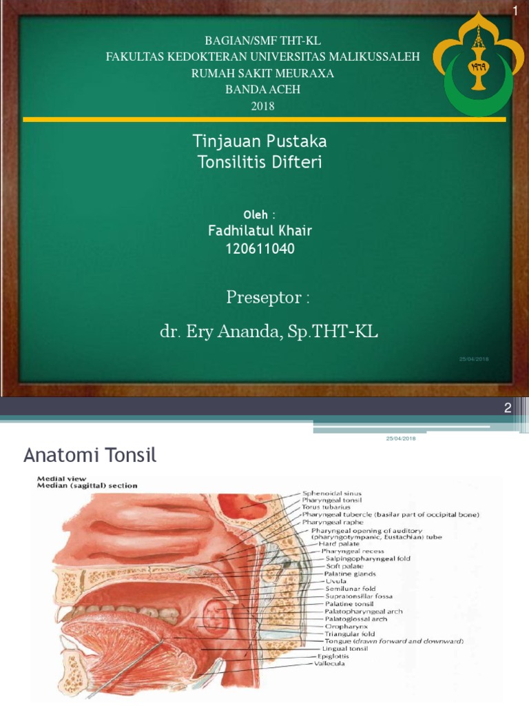 Tonsilitis Difteri | PDF