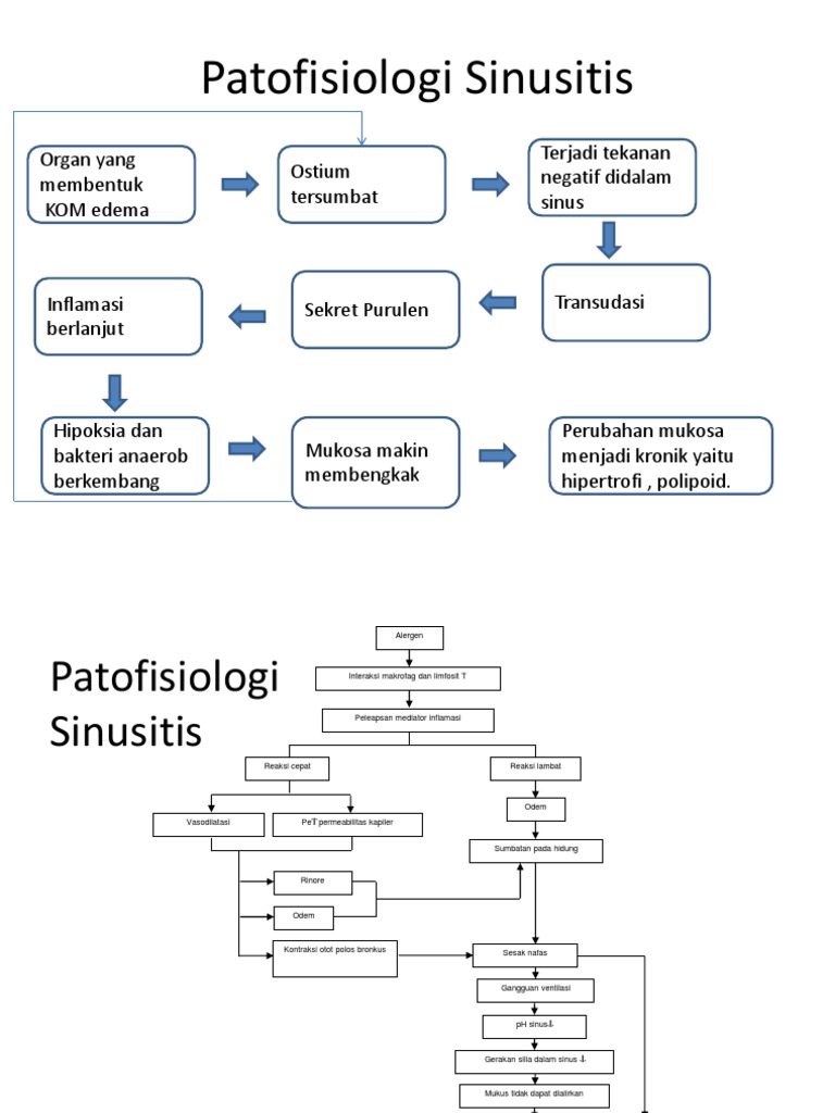 Patofisiologi Sinusitis | PDF