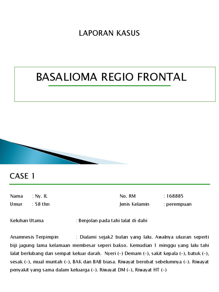 Basalioma Regio Frontal | PDF
