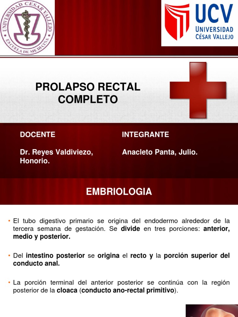 Prolapso Rectal Completo | PDF | Estreñimiento | Recto