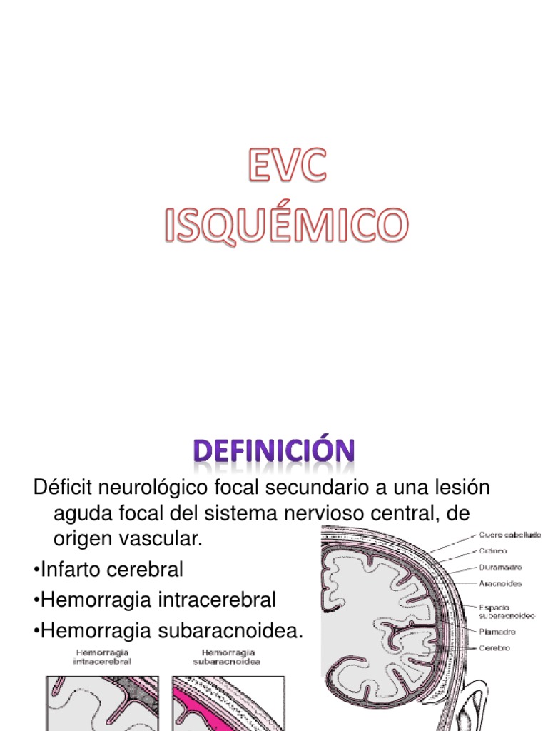 EVC Isquemico | PDF | Isquemia | Infarto de miocardio