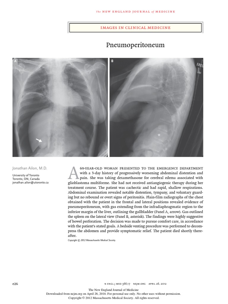 Pneumoperitoneum: Images in Clinical Medicine | PDF | Abdomen ...