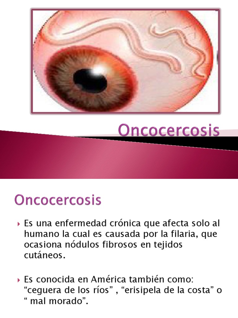 Oncocercosis: Causas y Tratamiento | PDF | Rtt | Enfermedades y trastornos