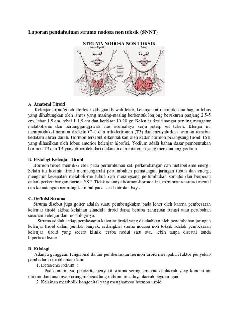 Laporan Pendahuluan Struma Nodosa Non Toksik | PDF