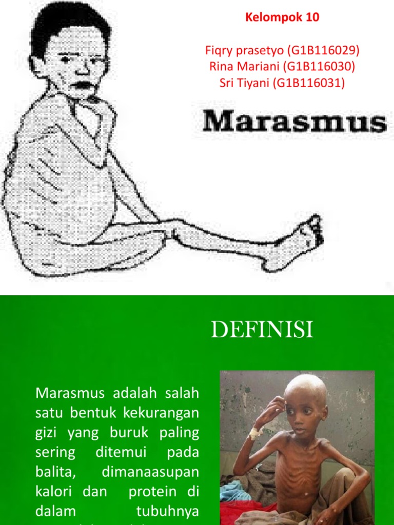 Penyakit Marasmus | PDF | Pengembangan Diri | Sains & Matematika