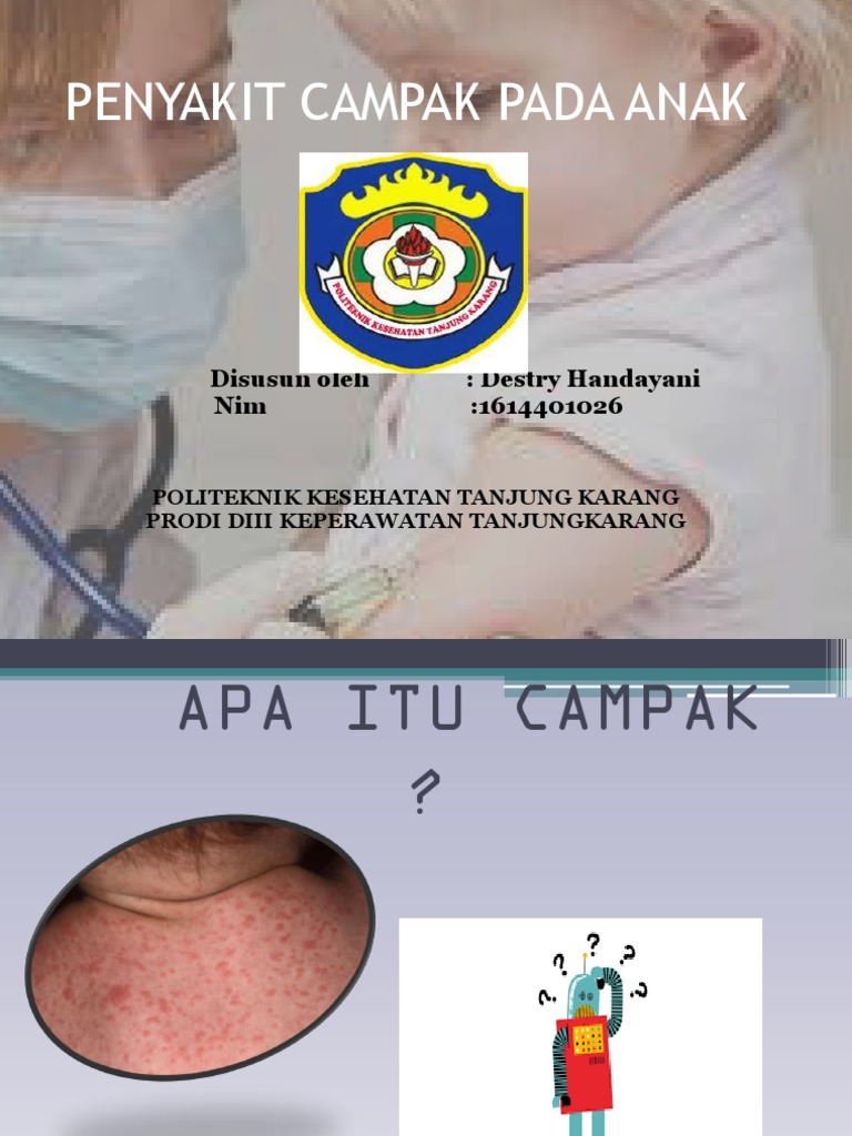 Penyakit Campak pada Anak: Gejala dan Pencegahan | PDF