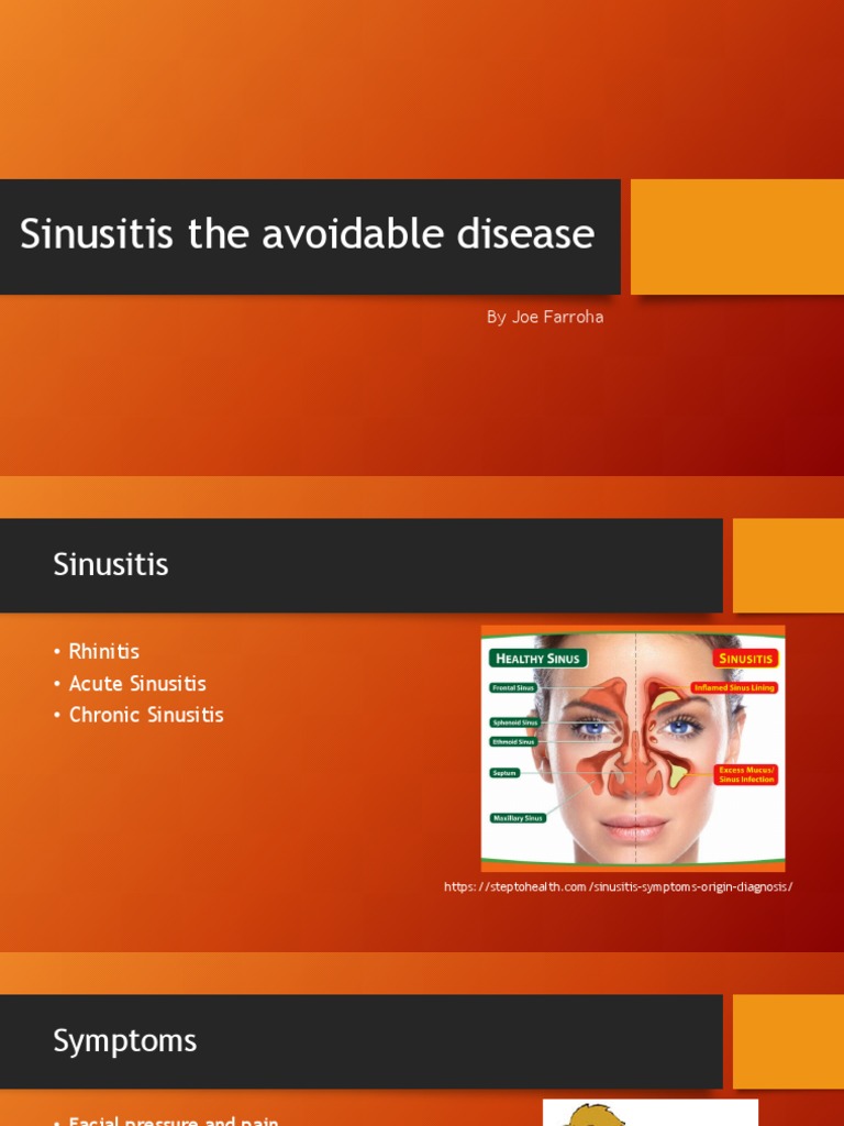 Sinusitis Presentation | PDF