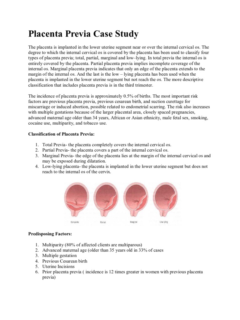 Placenta Previa Case Study Analysis | PDF | Mammalian Pregnancy ...