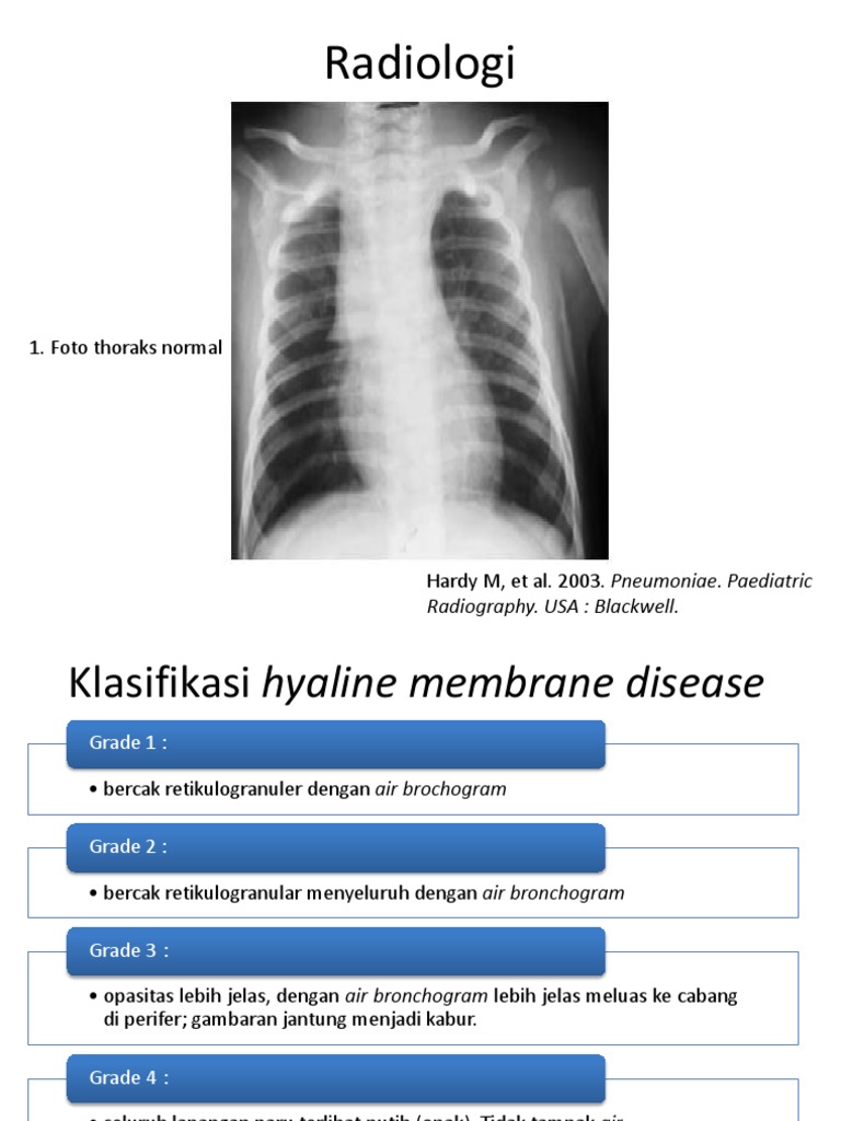 Radiologi HMD | PDF