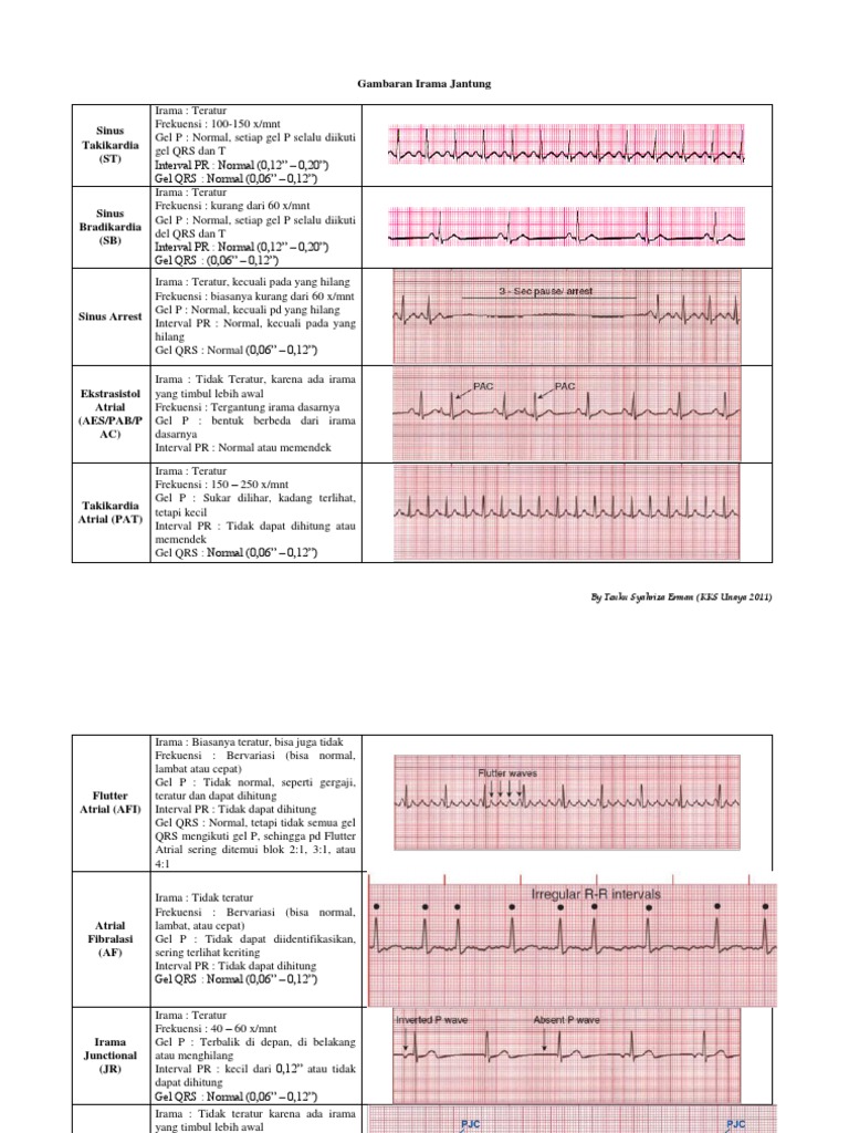 Gambaran Irama Jantung | PDF