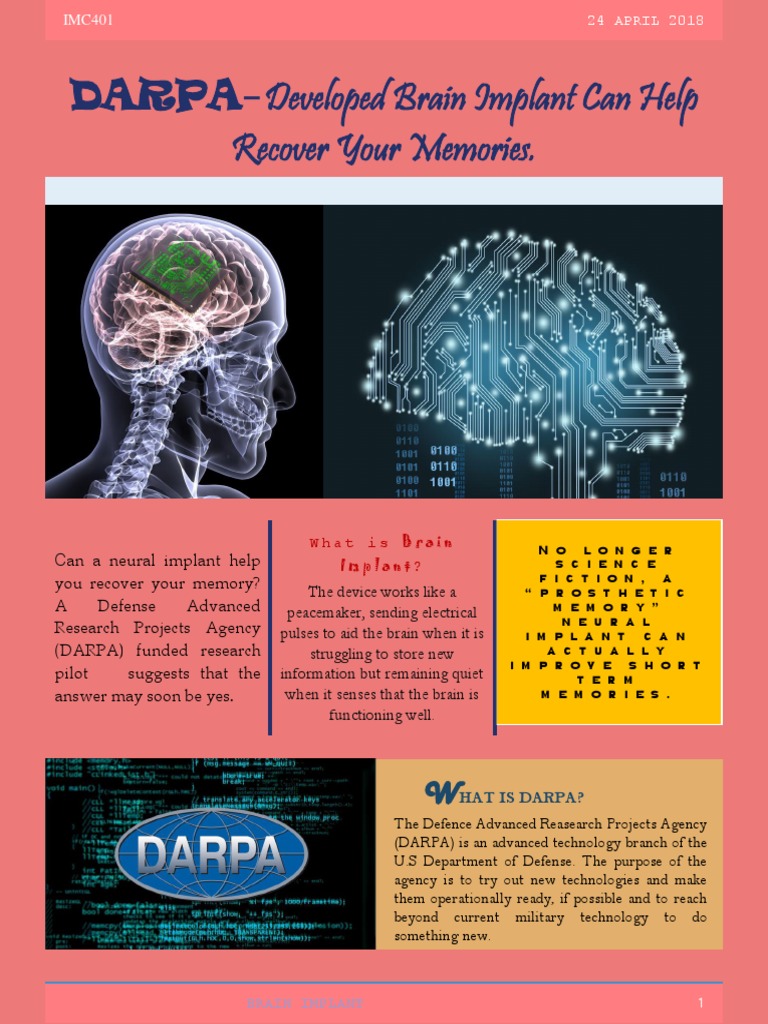 Brain Implant - IMC401 | PDF | Memory | Recall (Memory)