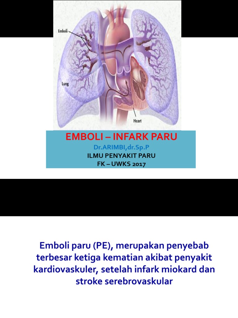 Emboli Infark Paru Fkuwks 2017 | PDF