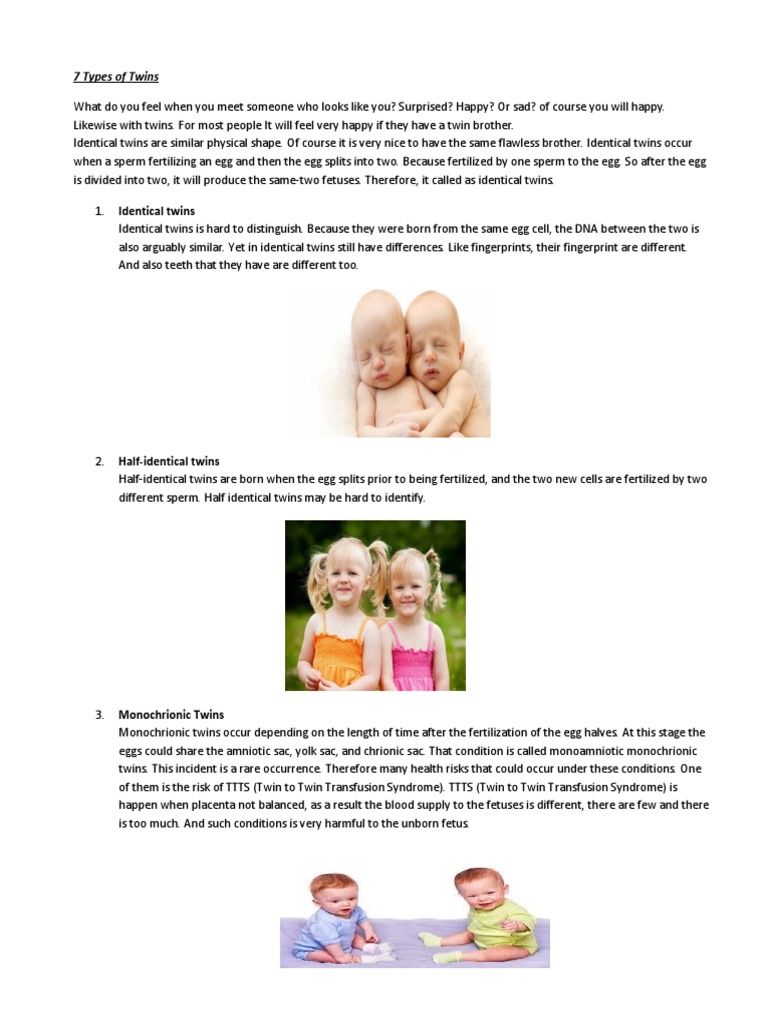 7 Types of Twins.docx | Conjoined Twins | Twin