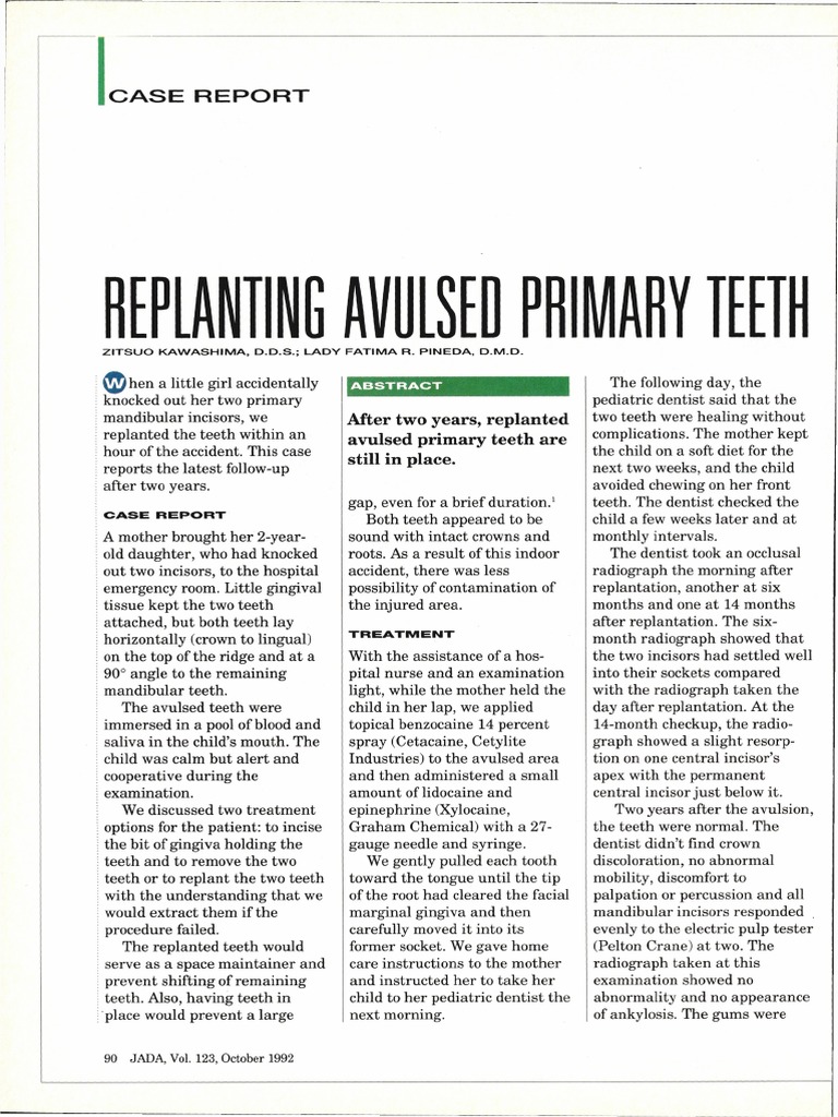 Replanting Avulsed Primary Teeth: Case Report | PDF | Human Tooth ...