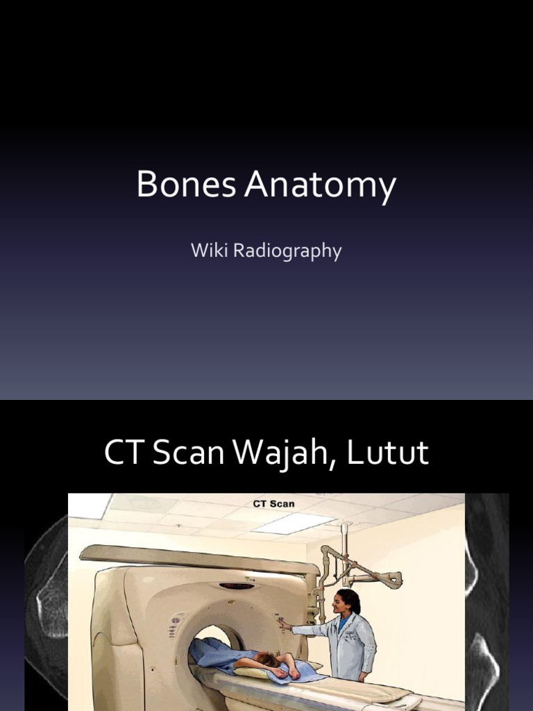 Bones Anatomy: Wiki Radiography | PDF | Vertebral Column | Elbow