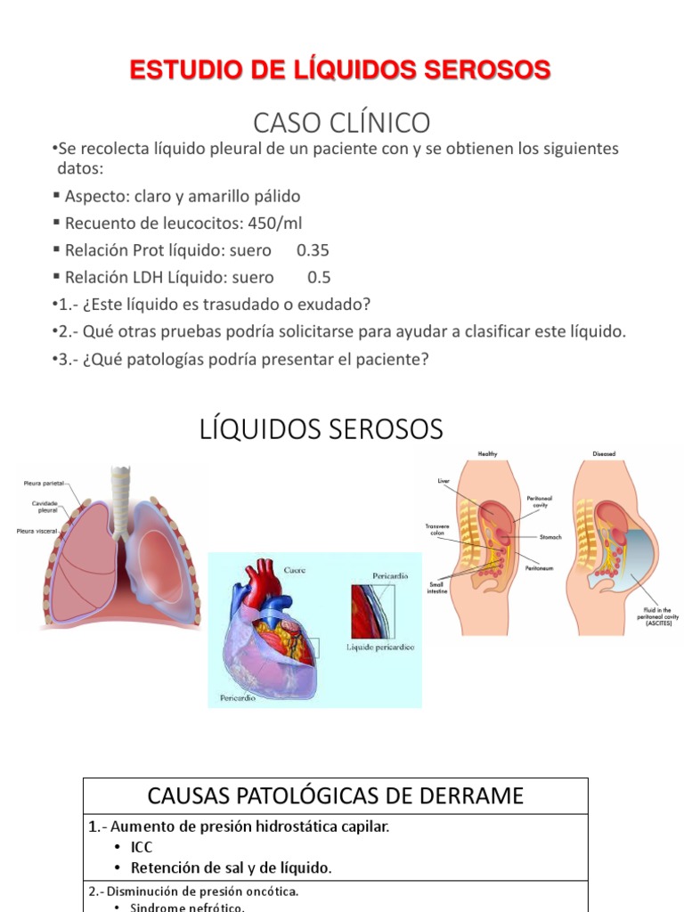 Líquido Serosos