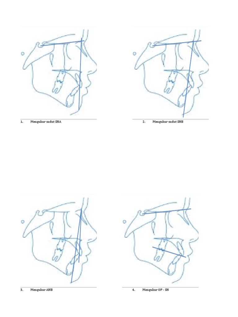 Analisis Steiner 1 | PDF | Perjalanan
