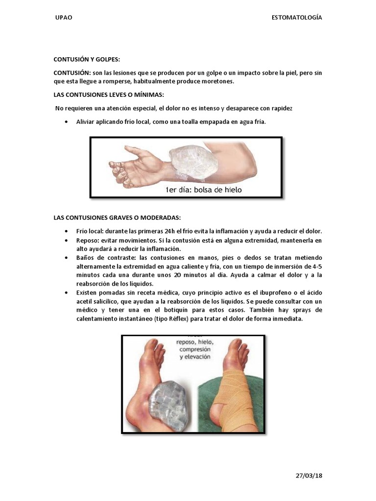 Primeros Auxilios para Contusiones y Golpes | PDF | Herida | Quemar