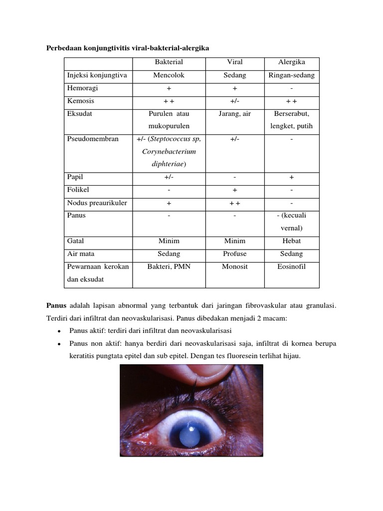 Konjungtivitis | PDF